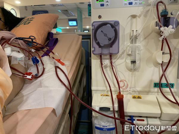 26yo Taiwan Woman Has 70% Of Kidneys Ruined After Drinking 2 Cups Of ...